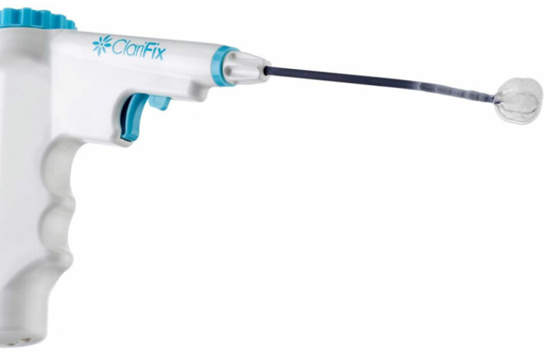 ClariFix®: Relief from Chronic Rhinitis | Ascentist Healthcare